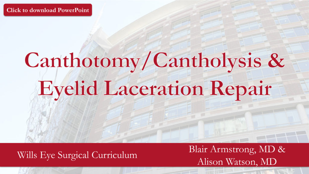 Canthotomy/Cantholysis & Lid Laceration Repair - Wills Eye Library
