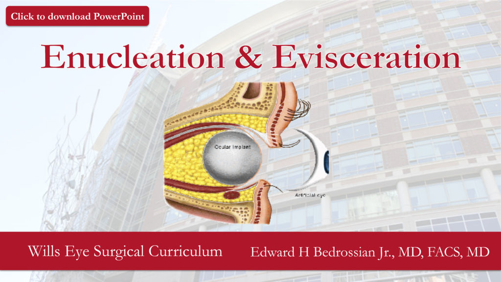 Enucleation & Evisceration - Wills Eye Library