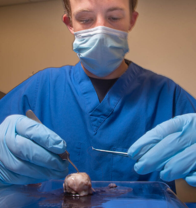 Enucleation & Evisceration - Wills Eye Library