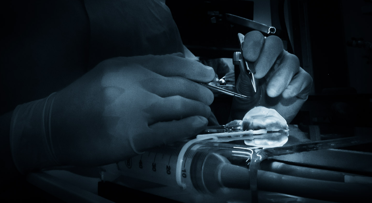 Corneal Suturing - Wills Eye Library